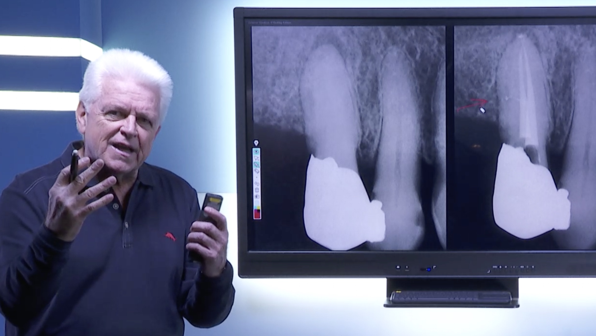 Endo Diagnosis 101 All You Need To Know Now